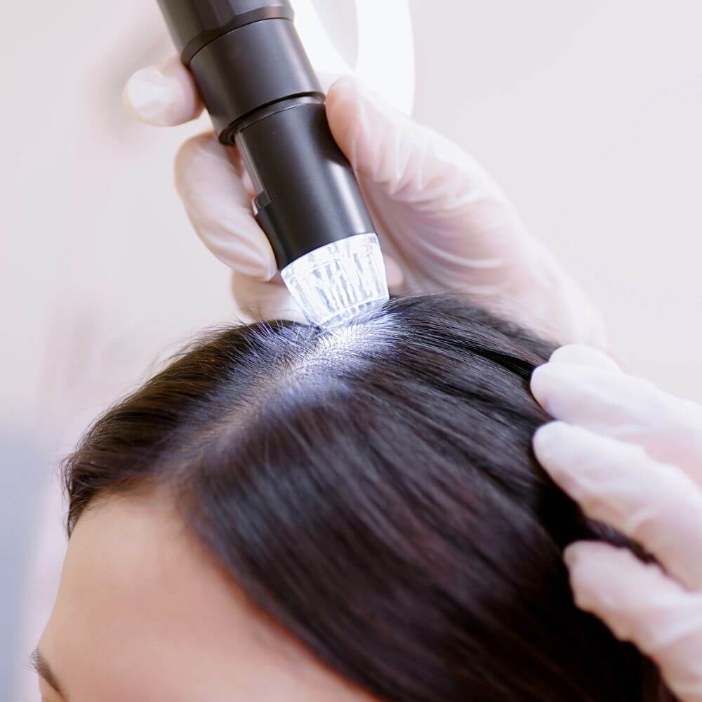 V Magic Hair Grow | Hair Growth Treatment in Singapore